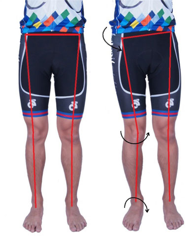 Feet First | Leg Length Inequality & Scoliosis